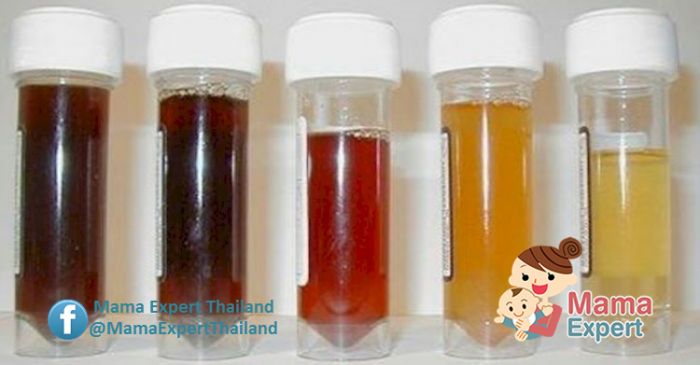 16 เรื่องควรรู้เกี่ยวกับปัสสาวะบอกโรค