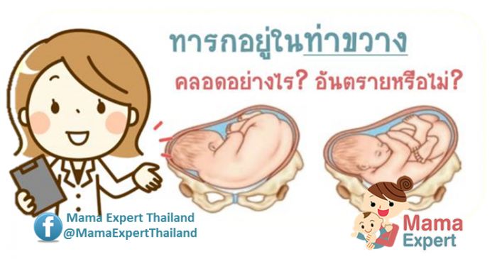 ทารกอยู่ในท่าขวาง (transverse position) คลอดอย่างไร อันตรายหรือไม่